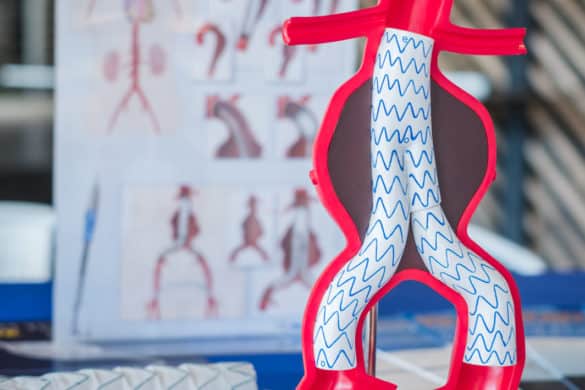 Organe im Bauch - Bauch.de