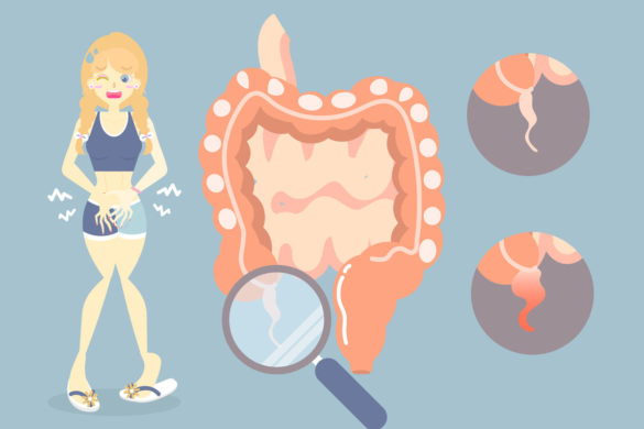 Bauchdecke / Bauchwand - Bauch.de